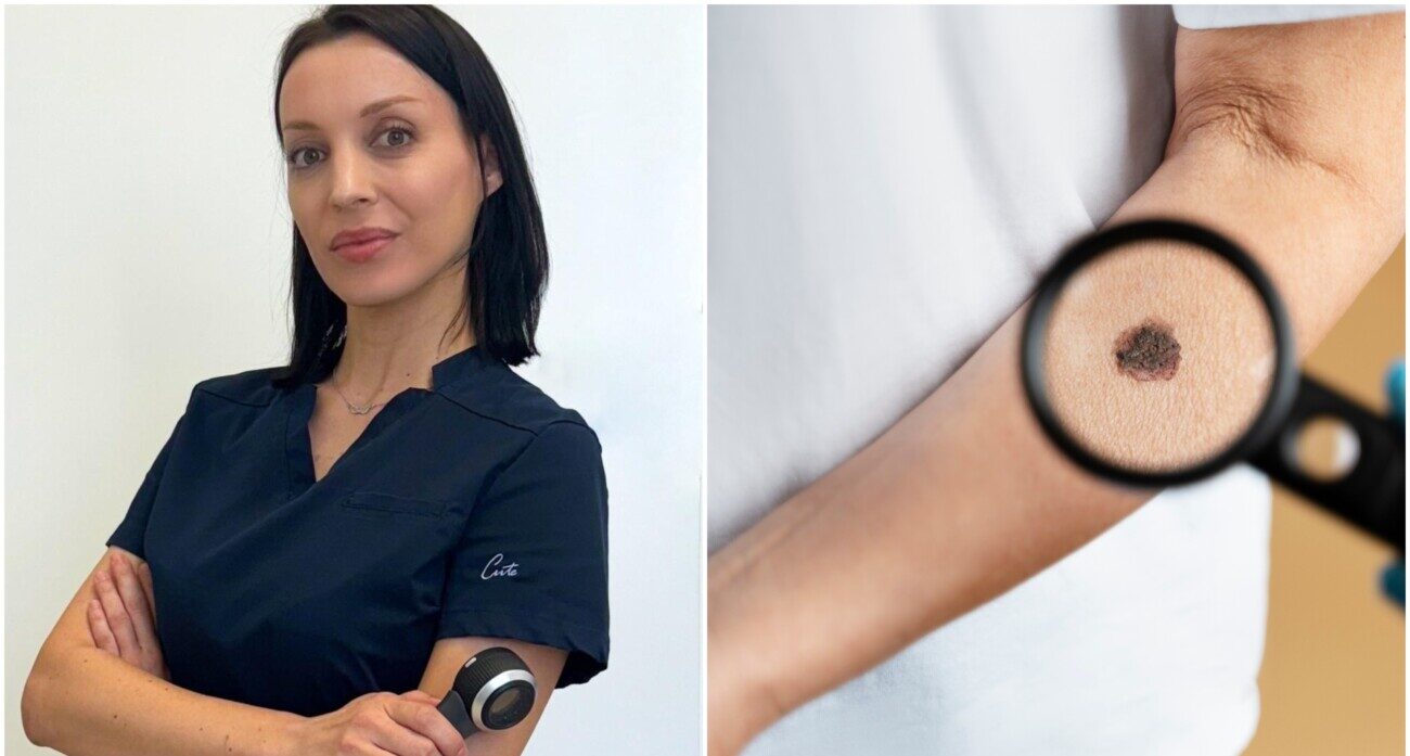 Udruga Srca za nju organizira besplatne preglede madeža za bolesne žene | Riportal