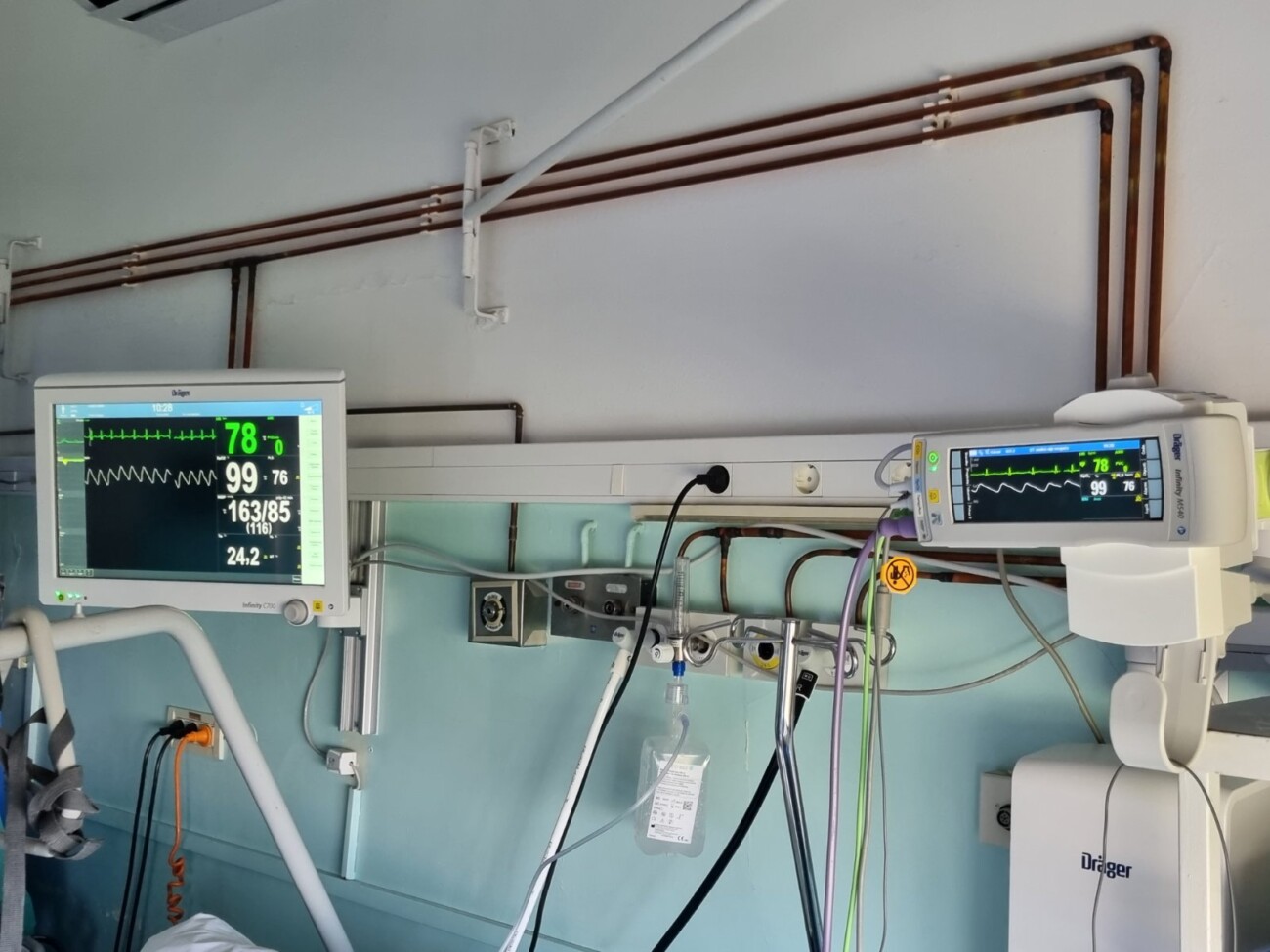 Kardiološka skrb u KBC Rijeka na zavidnoj razini: Stigla nova oprema vrijedna 400 tisuća eura ...