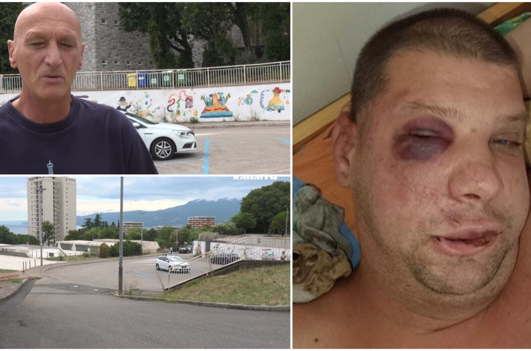 Prošlo je tjedan dana od brutalnog napada na Zametu: Tko je pretukao osobu s intelektualnim ...